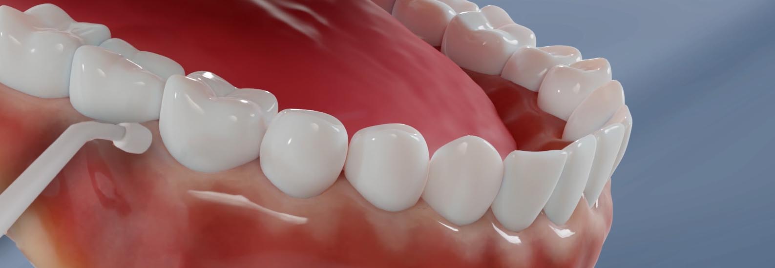 Beyond Brushing: How to Floss with Proper Technique - Millard Family ...